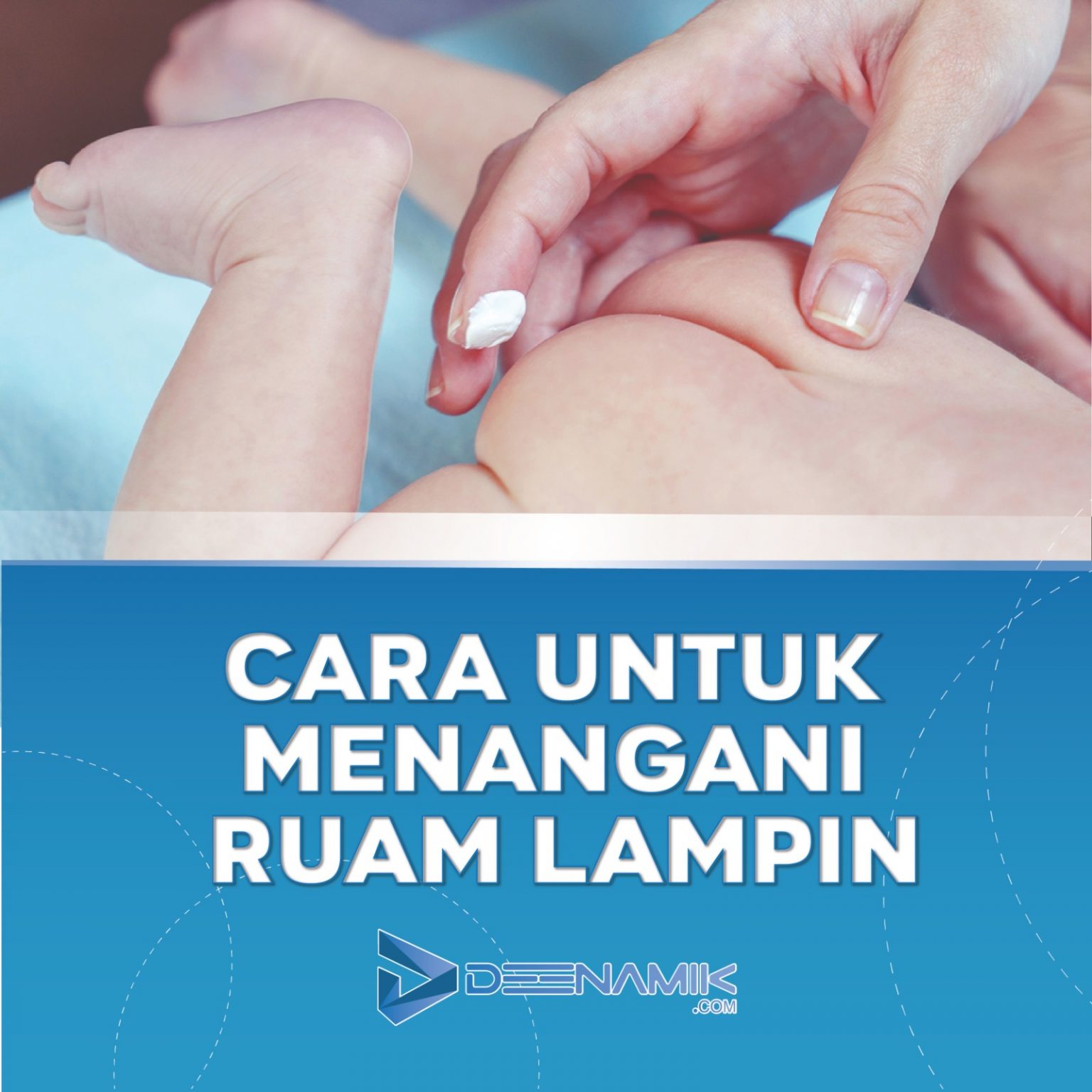 Cara untuk Menangani Masalah Ruam Lampin pada Bayi Anda.